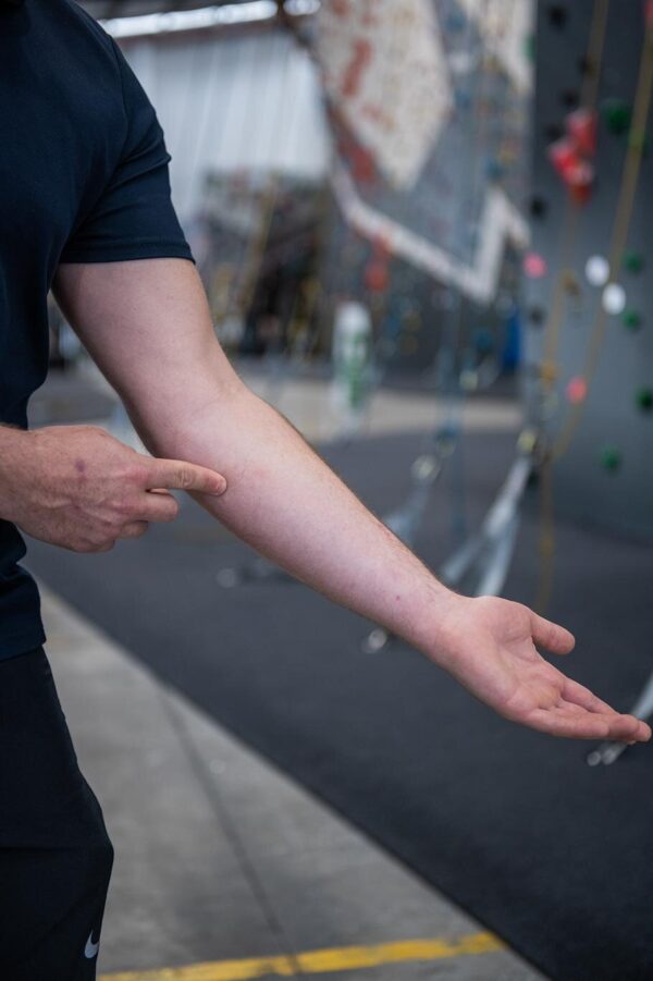 What is Climber's Elbow and how to treat it - Climb Fit